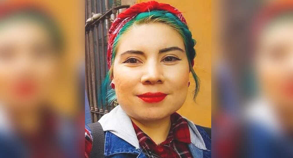 De emergencia Dulce fue sometida a cirugía por tumor, piden apoyo para ...