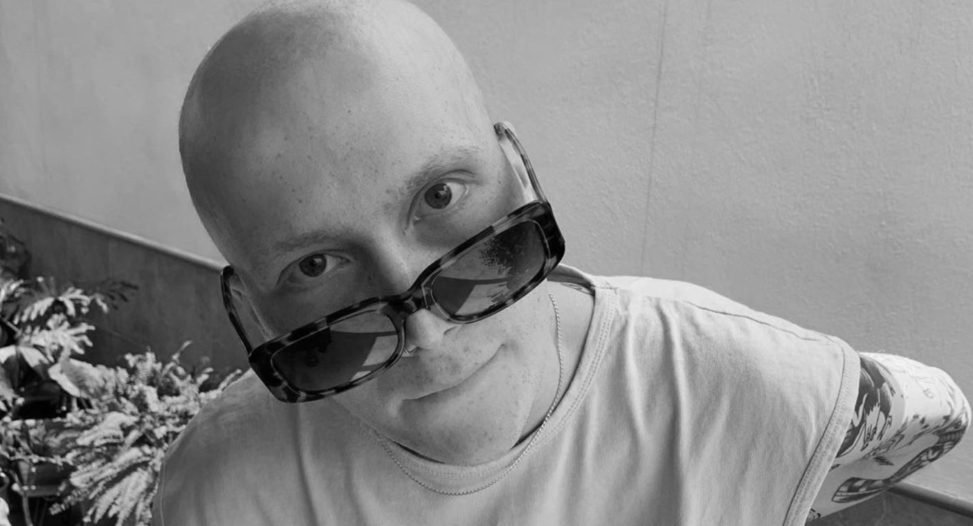 Fallece Charlie, el influencer que usó TikTok para hablar de su ...