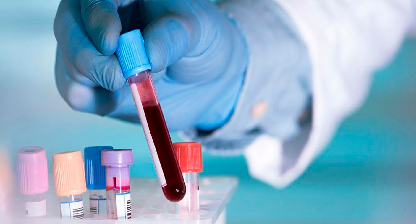 Un Análisis De Sangre Podría Detectar Hasta 50 Tipos De Cáncer Antes De