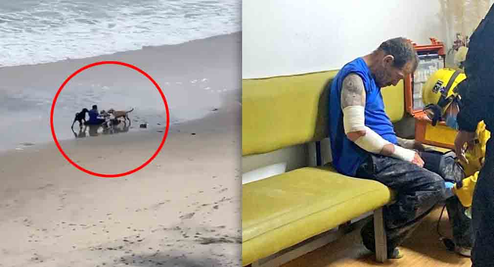 Hombre sufre ataque de perros en playas de Tijuana (VIDEO) - Proyecto ...