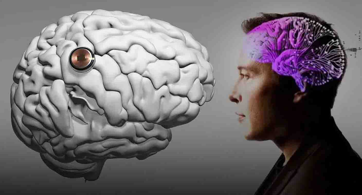 Este Es El Implante Para Controlar Dispositivos Con La Mente De