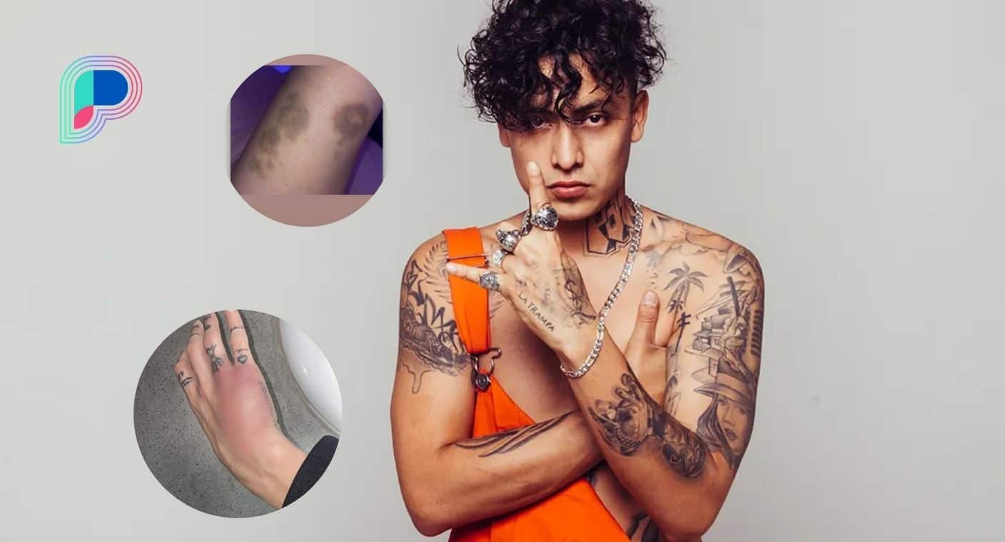 Denuncia Akasha al rapero Alemán por agredirla físicamente en su ...